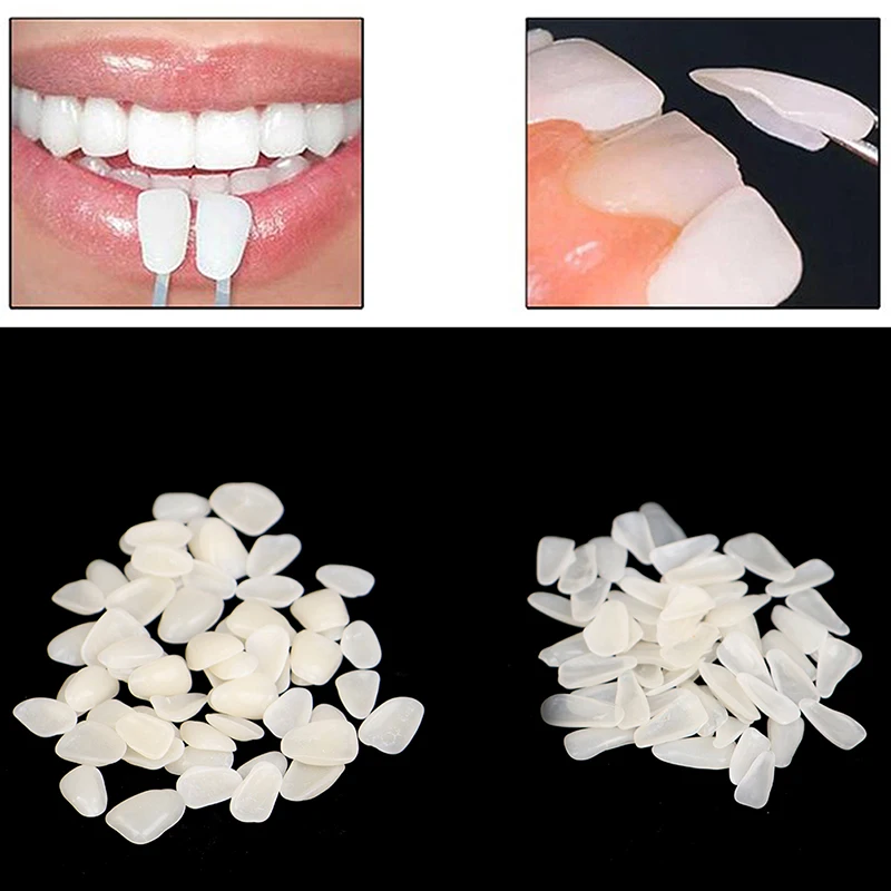 60PC-Dental-Ultra-Thin-Whitening-Veneers-Resin-Porcelain-Materials ...