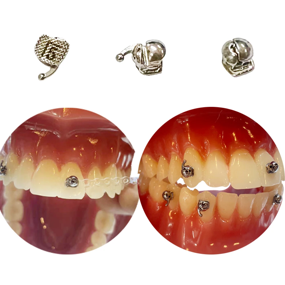 28 Pieces Dental Orthodontics Spherical Bracket 022 MBT Roth Non ...