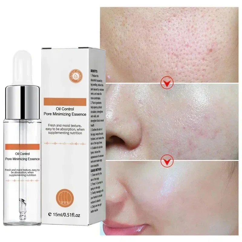 Face-Pore-Shrinking-Serum-Removing-Large-Pores-Tightening-Skin-Get-Rid-Of-Acne-Marks-Repairing ...