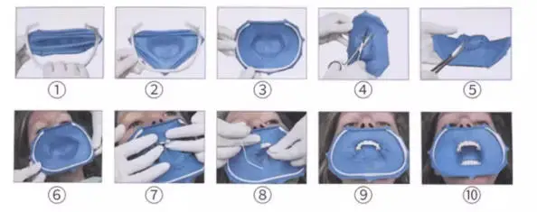 High quality Kerr Dental Non-Punch Rubber Dam Sheet, Mouth Opener & 3D ...