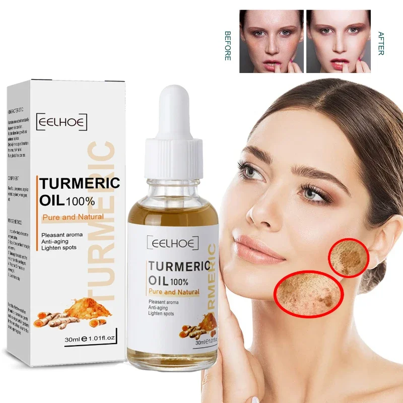 Freckle-Remove-Turmeric-Serum-Curcumin-Oil-Face-Whitening-Brighten ...