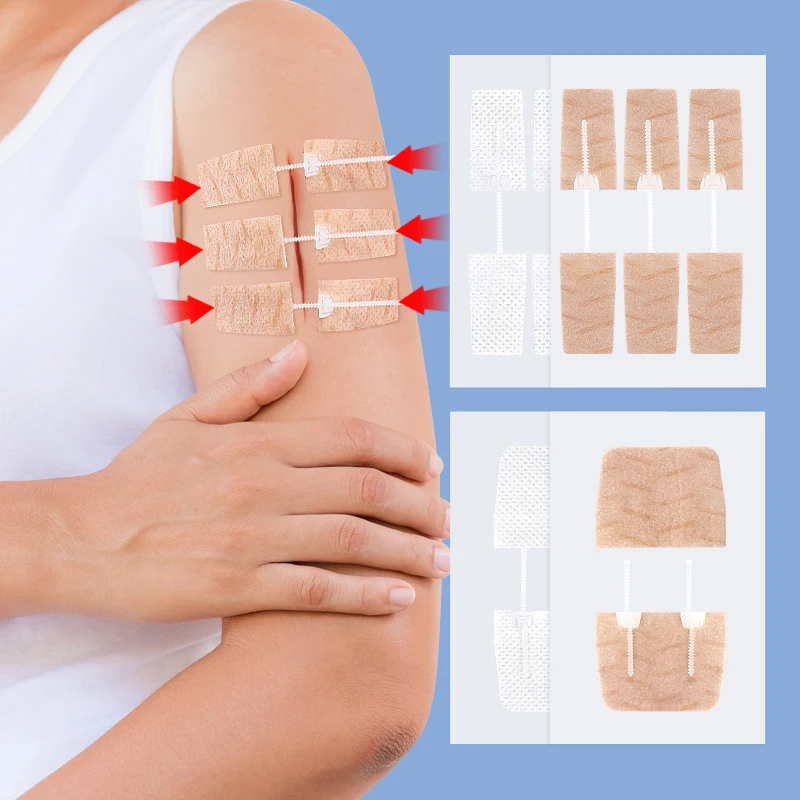 Emergency-Waterproof-Wound-Closure-Strips-Lock-And-Pull-Adhesive ...