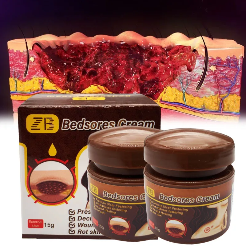 ZB-Removal-Rot-Myogenic-Cream-Cure-Bedsores-Pressure-Sores-Ulcer ...