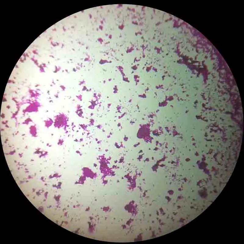 Clostridium Tetani Slide