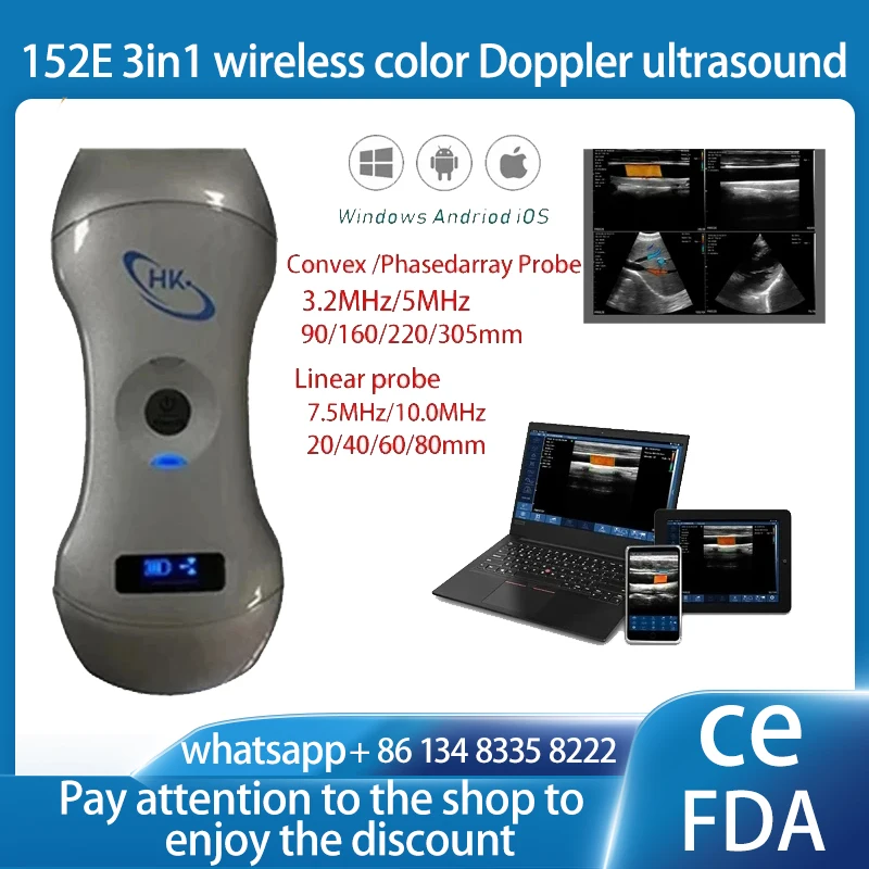 Free-DHL-Delivers-Fast-Shipping-152E-3-in-1-portable-machine-Wireless-Ultrasound-Probe-scanner ...