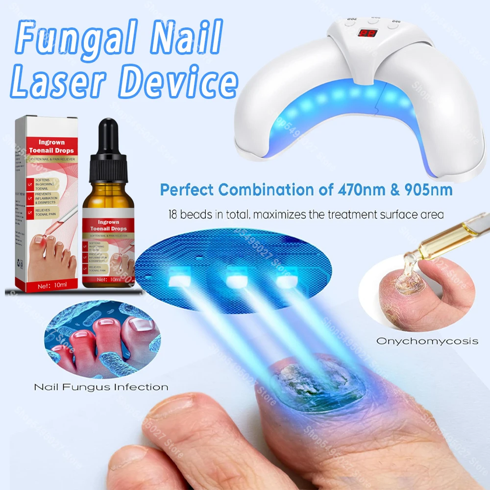 Fungal-Nail-Laser-Device-Repair-Fast-Nails-Fungus-Onychomycosis-Repair ...