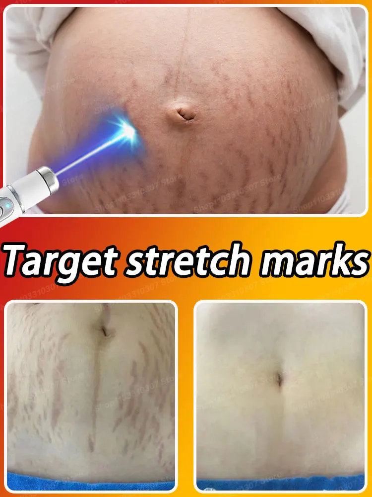 Blu-ray-pen-mejora-la-crema-de-estr-as-antiguas-blancas-rojas-para-el ...