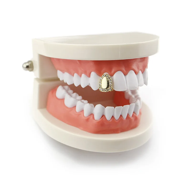 Dentures With Gold On Them