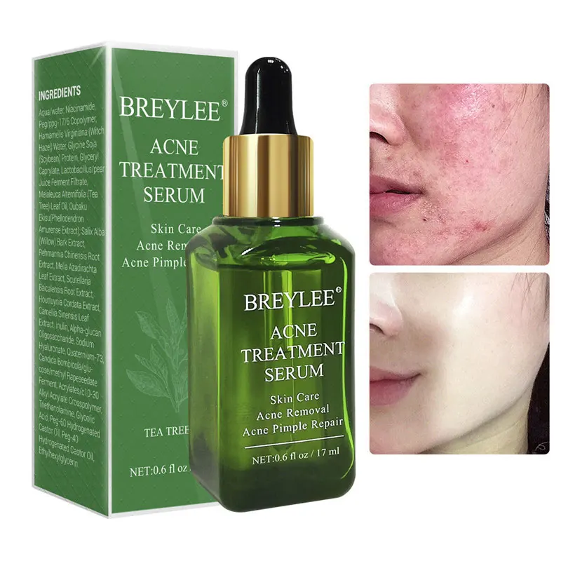 BREYLEE Acne Treatment Face Serum Mask Anti Acne Pimple Scar Remover Moisturizing Whitening Skin ...
