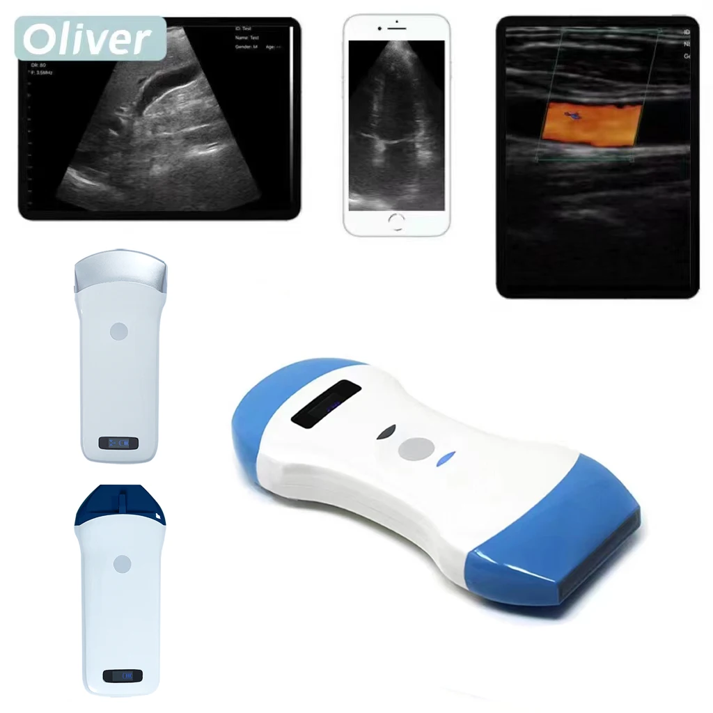 Wireless-Ultrasound-Probe-scanner-portable-Bluetooth-machine-WIFI ...
