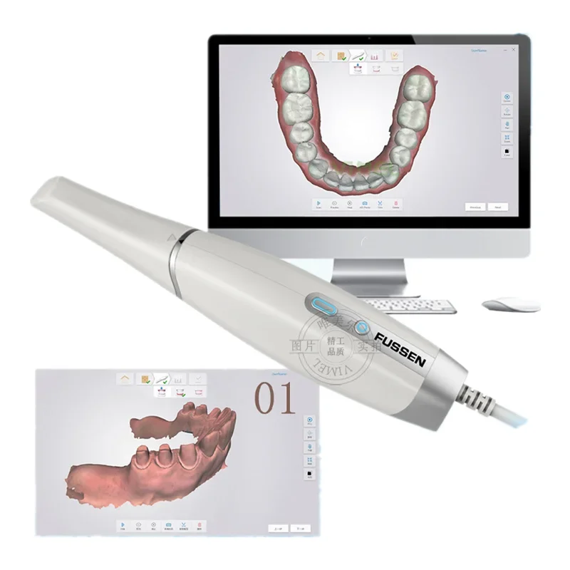 2-Year-Warranty-Portable-Fussen-Digital-Intraoral-Scanner-System-S6000 ...