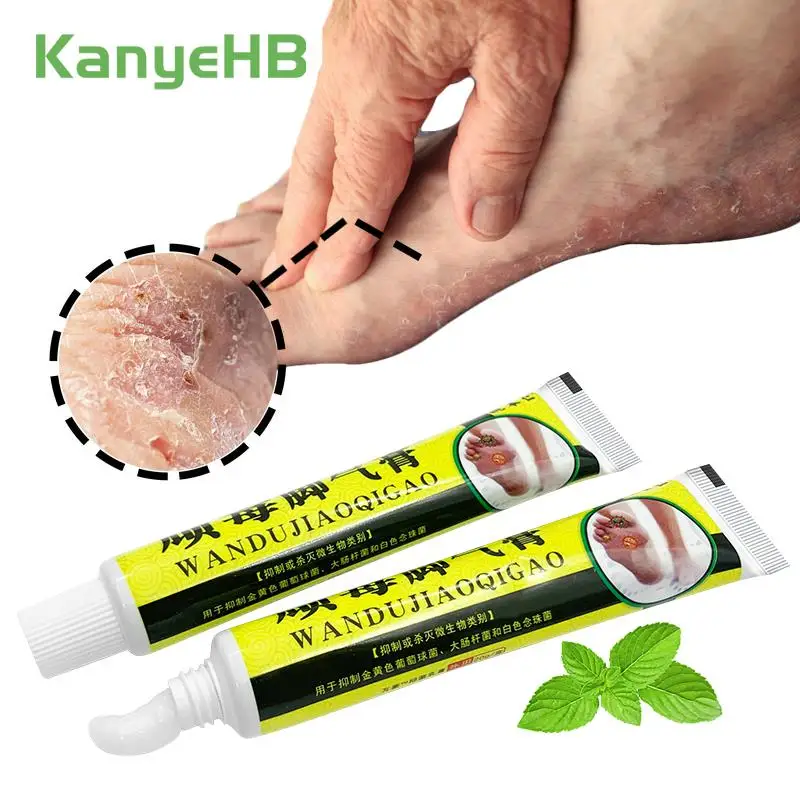 2Pcs-Tinea-Pedis-Inhibit-Fungi-Cream-Treatment-Beriberi-Foot-Odor ...