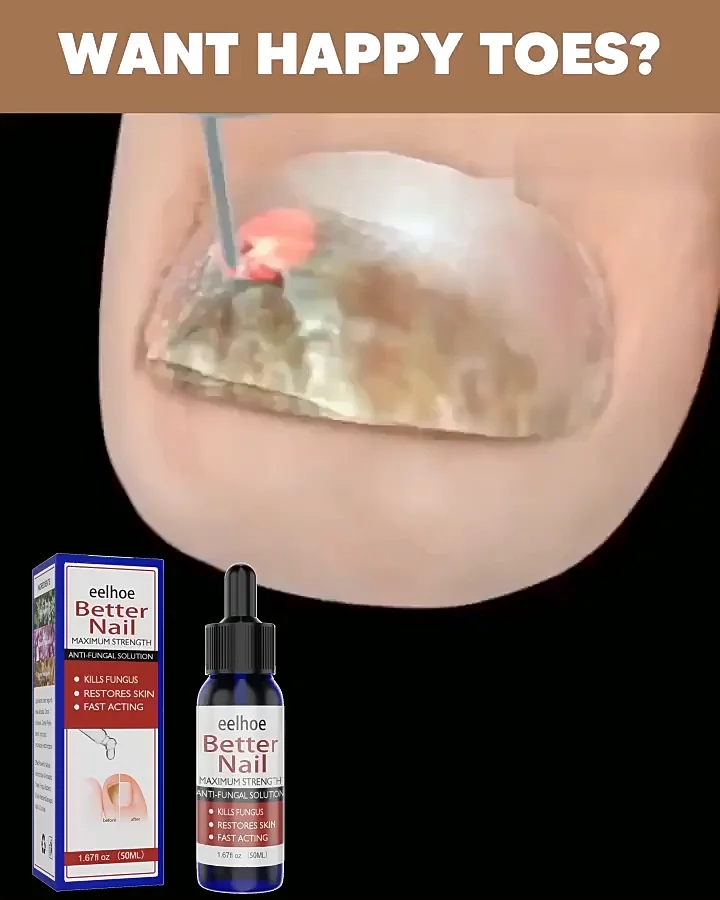 Anti Paronychia Relief Oil Ingrown Toenail Drops Anti Fungal Nail ...