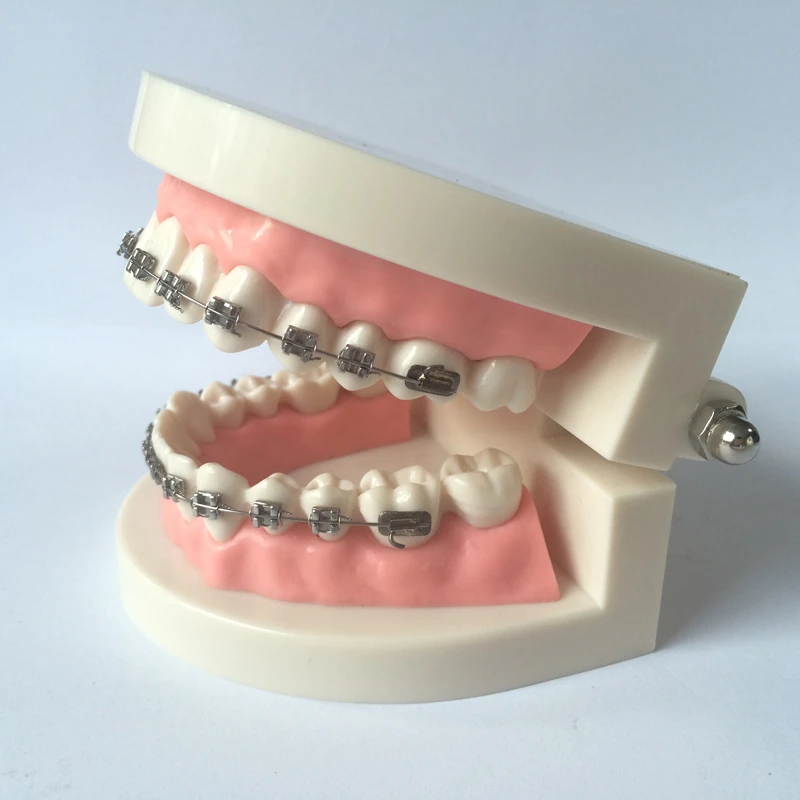Dental orthodontic model with brackets/Dental teeth model with lingual ...