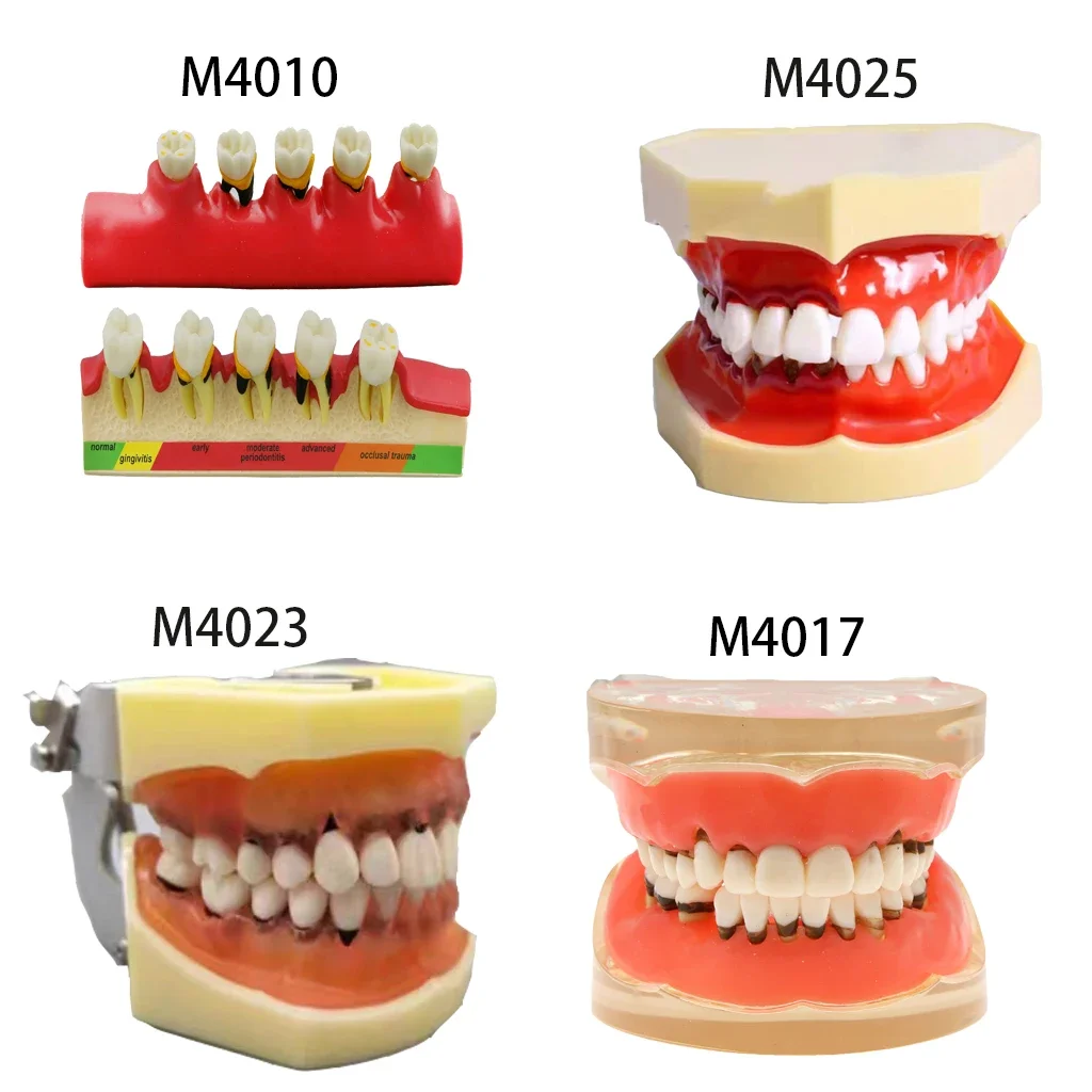 Dental-Adult-Pathological-Typodont-Teeth-Model-Endodontic-Disease ...