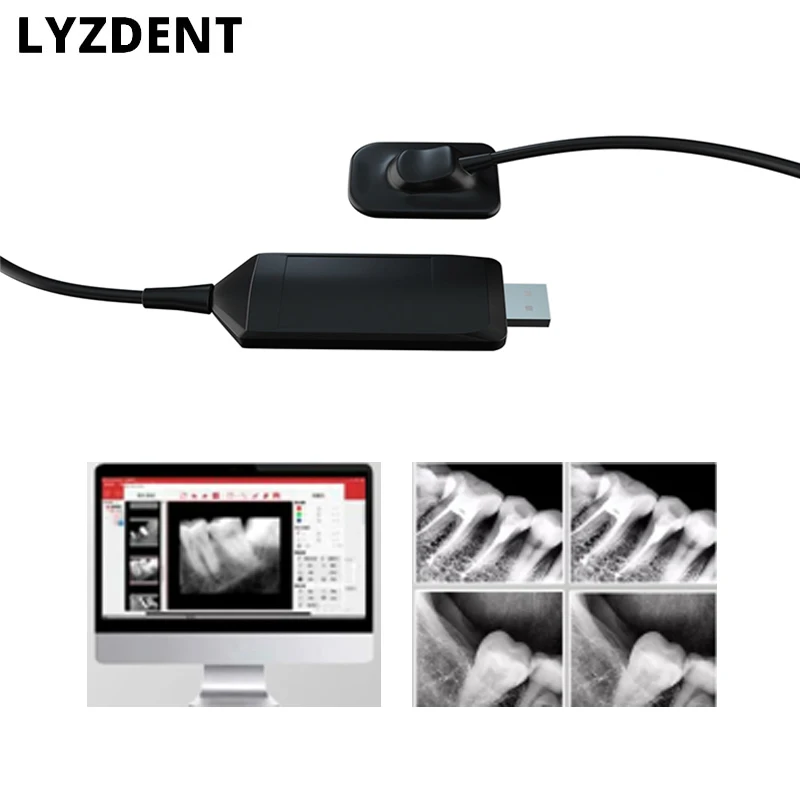 Dentistry-Digital-cameras-Dental-X-Ray-Sensor-High-Frequency-Rx-Digital ...