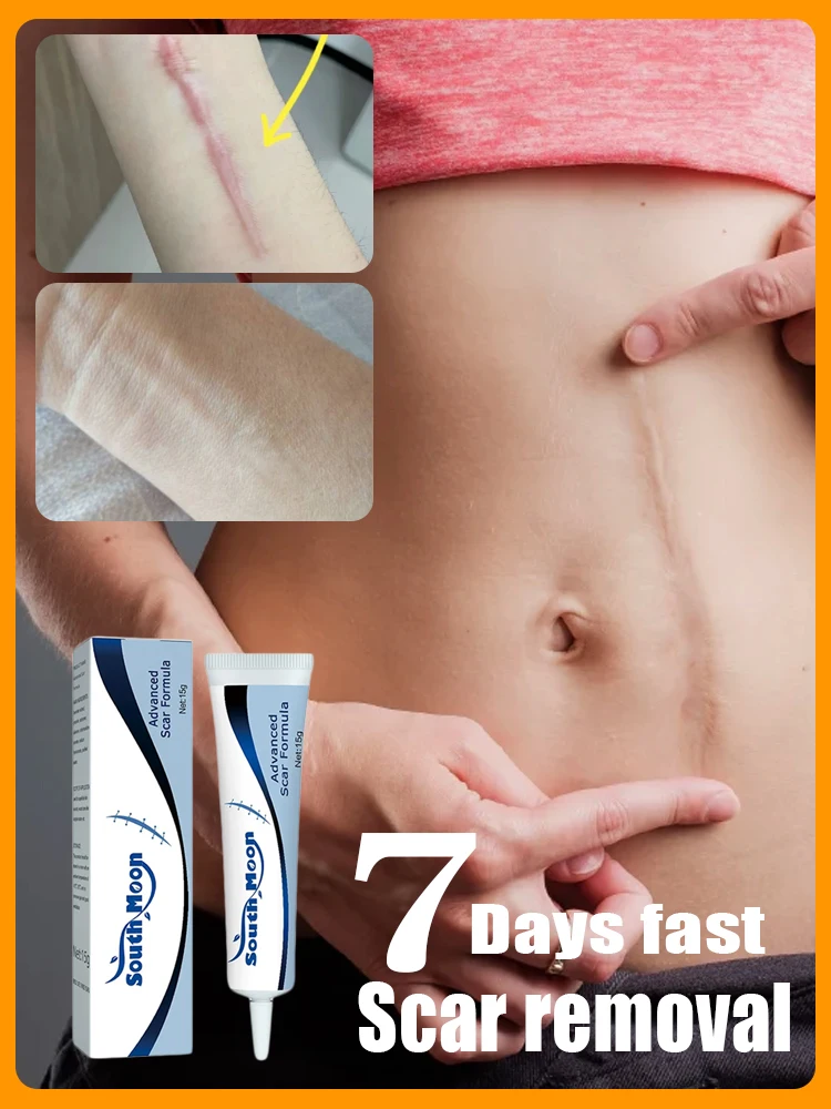 Remove-various-scars-stretch-marks-surgical-scars.jpg