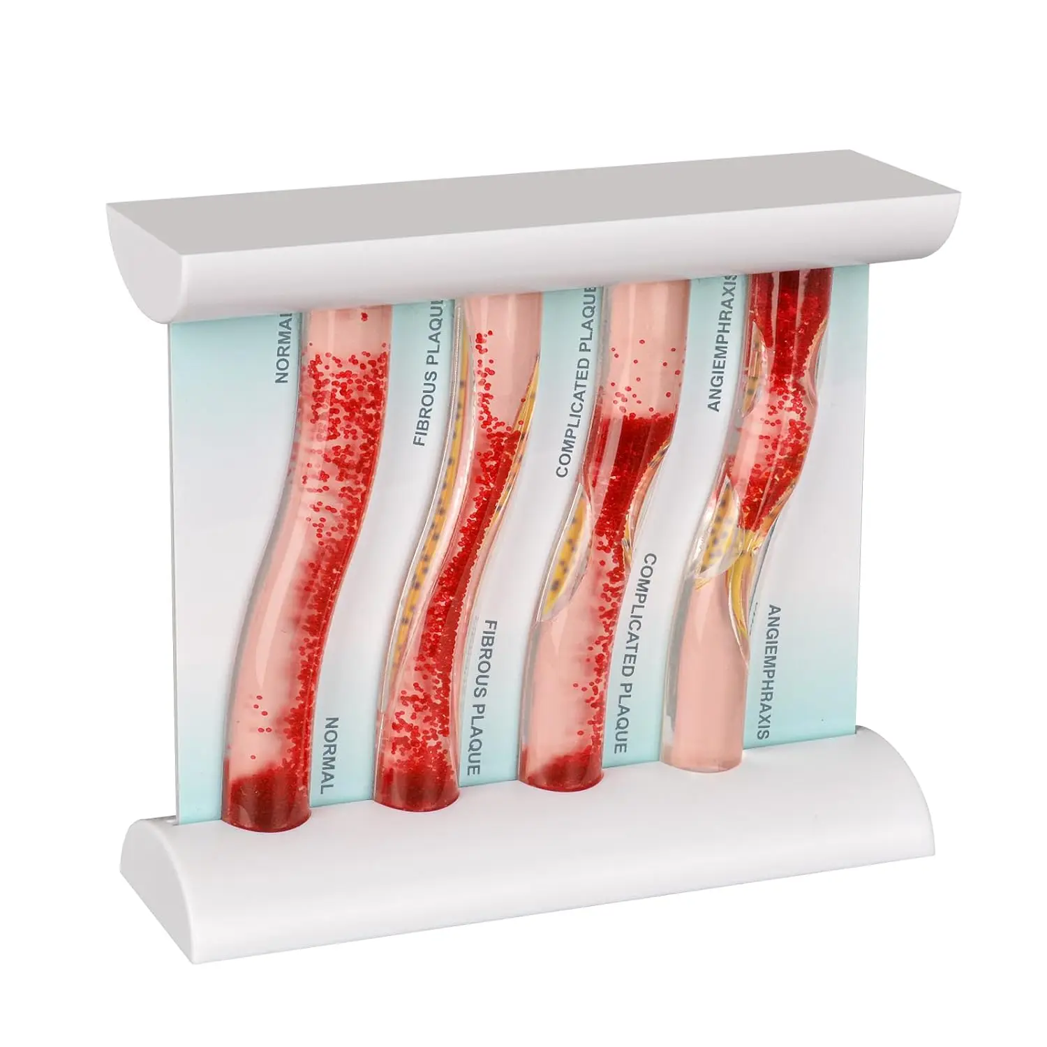Dynamic Blood Vessel Model Cardiovascular Blockage Contrast Thrombosis ...