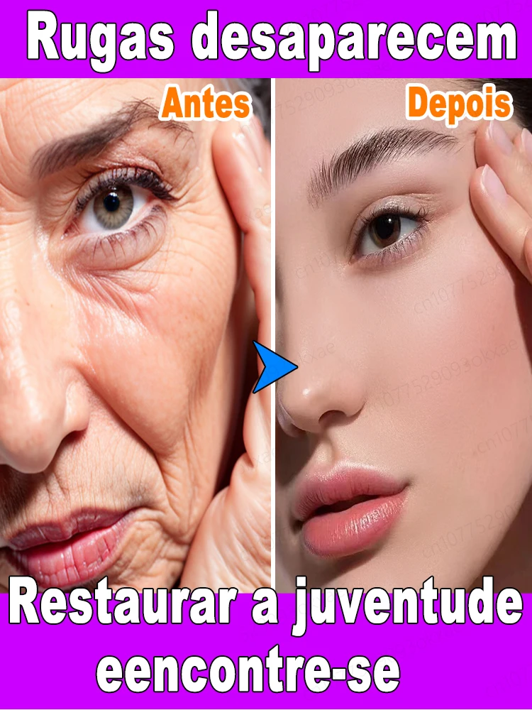 Leva-apenas-7-dias-para-se-livrar-das-rugas-O-leo-essencial-anti-rugas ...