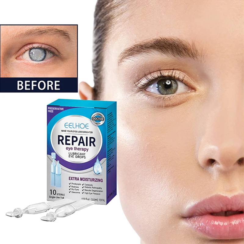 Eye-Drop-Improve-Eyesight-Protection-Relieve-Eyes-Fatigue-Dry-Itchy ...