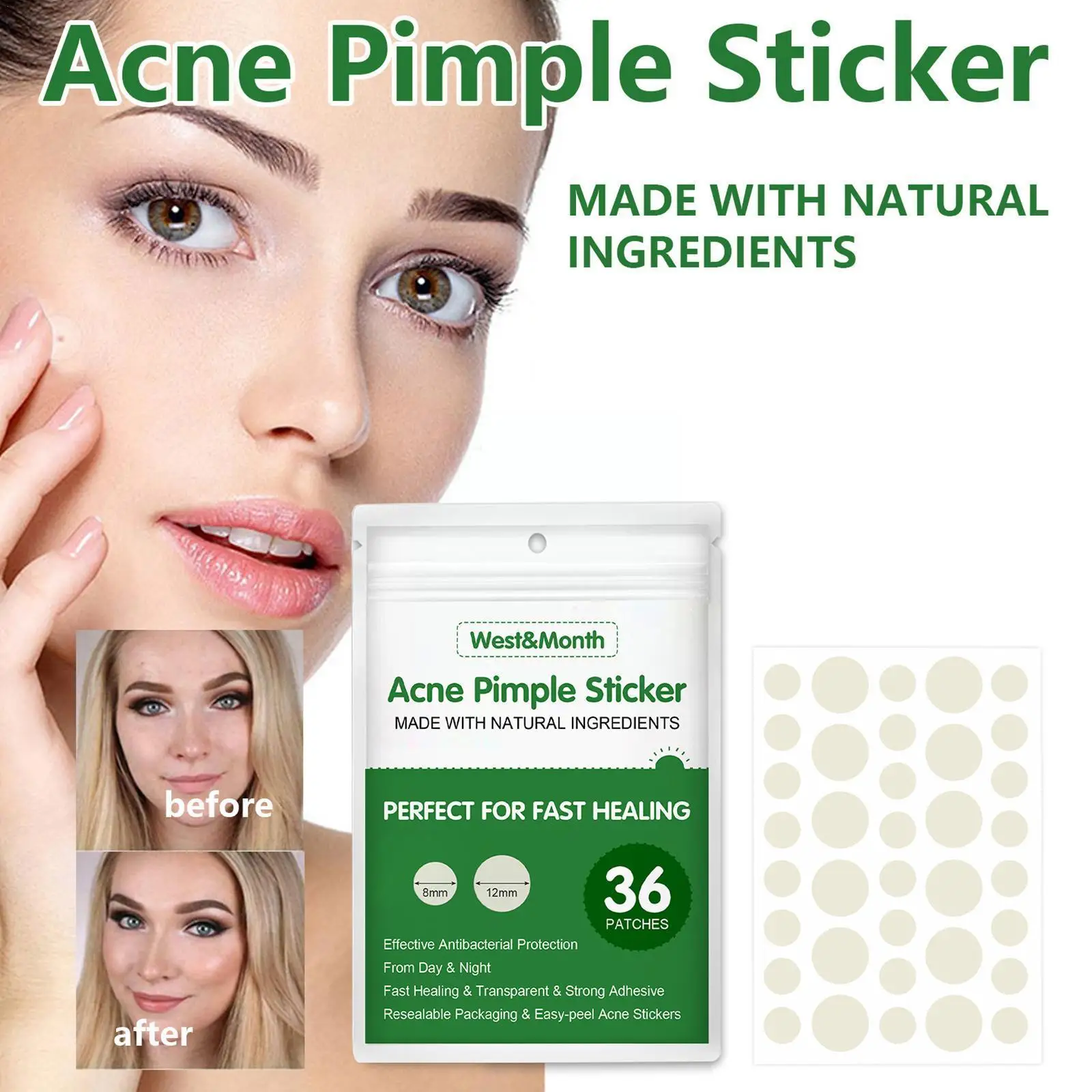 36 Patches Waterproof Acne Pimple Patch Stickers Acne Breathable ...