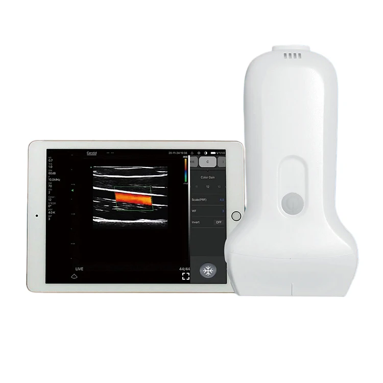 MSLPU79-USB-WIFI-Portable-Color-Doppler-Ultrasound-Probe-Convex-Linear ...