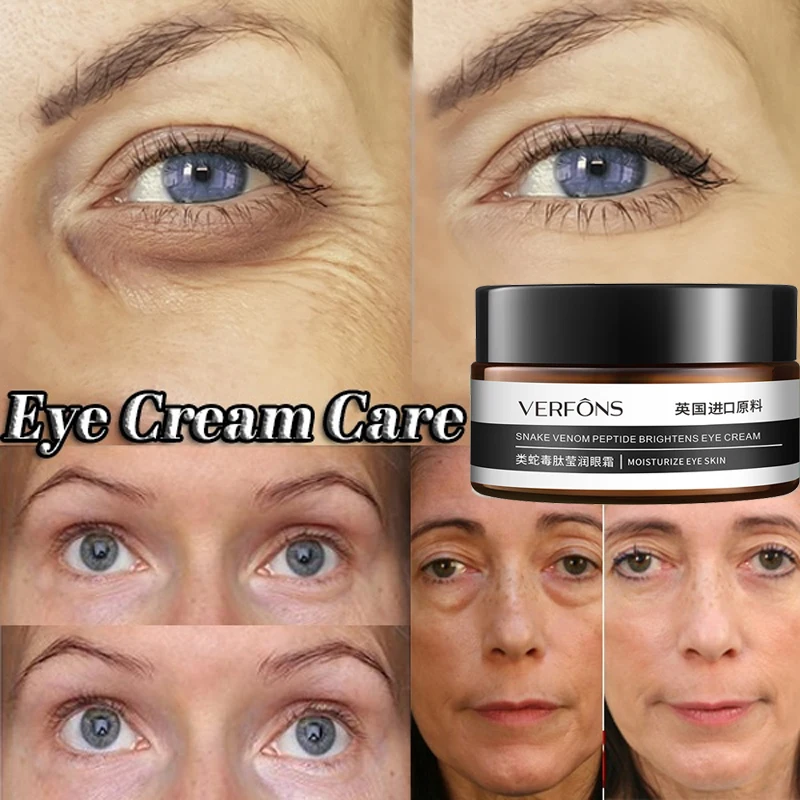 Verfons Snake Moisturizing Eye Cream Dark Circles Eye Care Cream Night ...