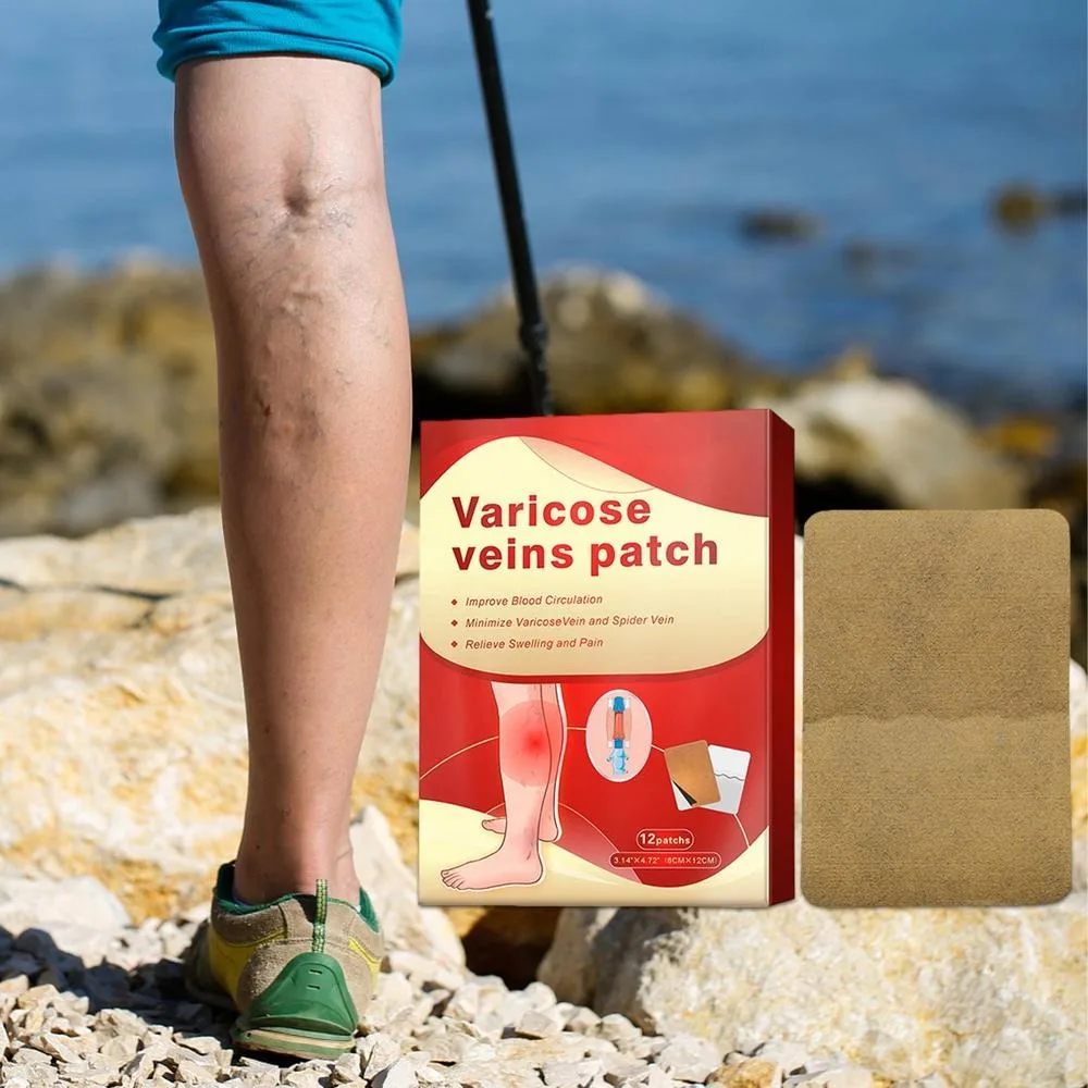 Treatment-Medical-Care-Relieving-Herbal-Patch-Vein-Free-Earthworm-Leg ...