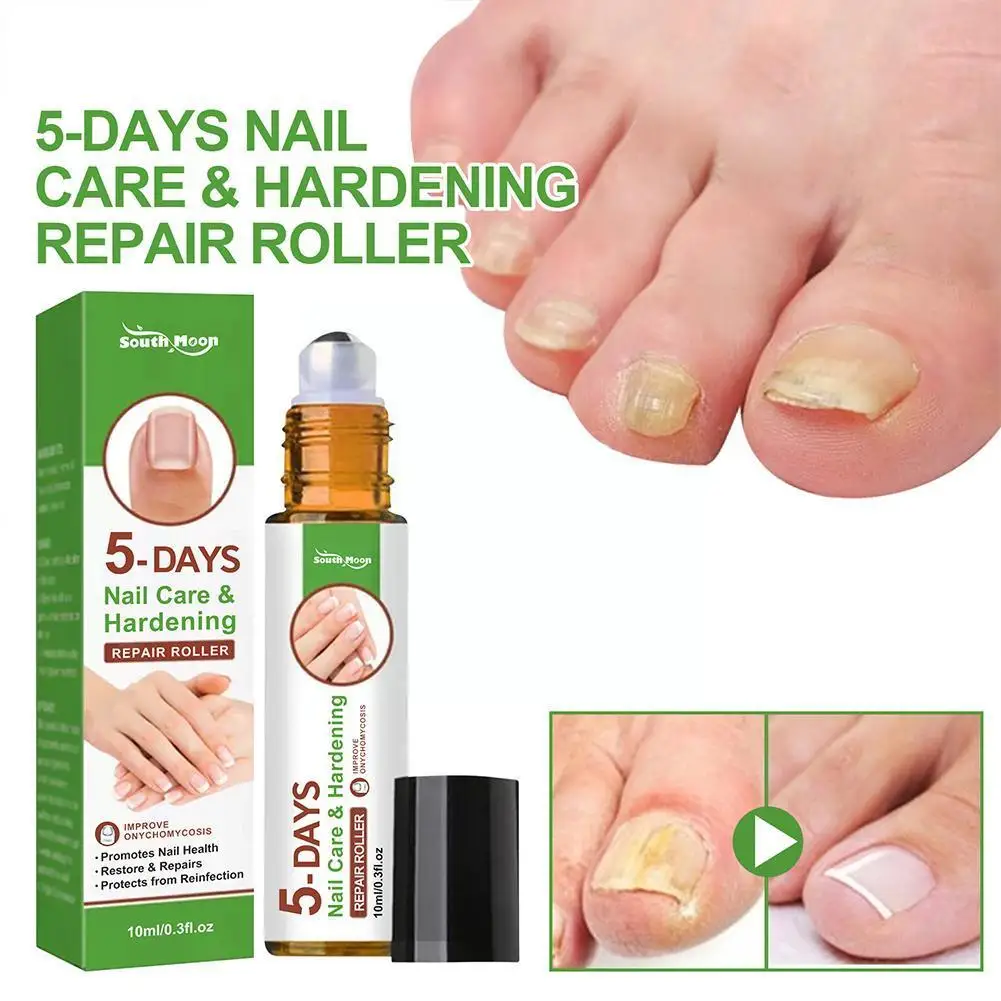 5-Days-Nail-Growth-And-Hardening-Repair-Roller-Nail-Nail-Solution-Nail ...