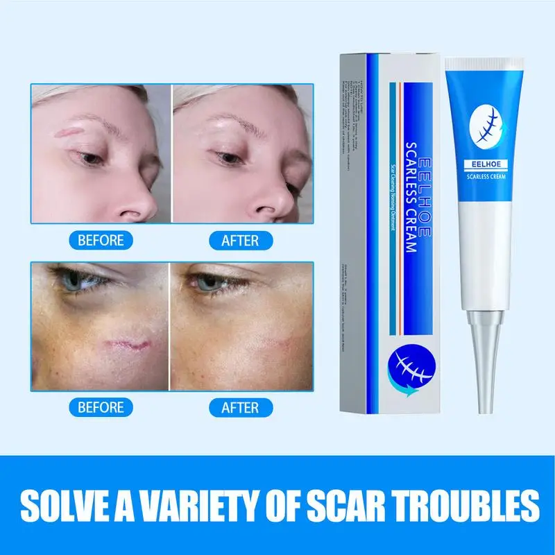 Scar Removing Gel With Effective Function Healthy And Safe Waterproof ...