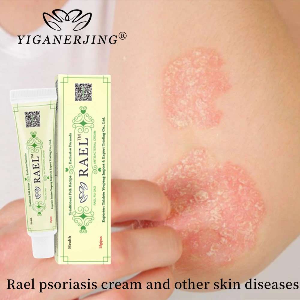 Rael Psoriasis Cream Yiganerjing Eczema Cream alivia la Dermatitis de ...