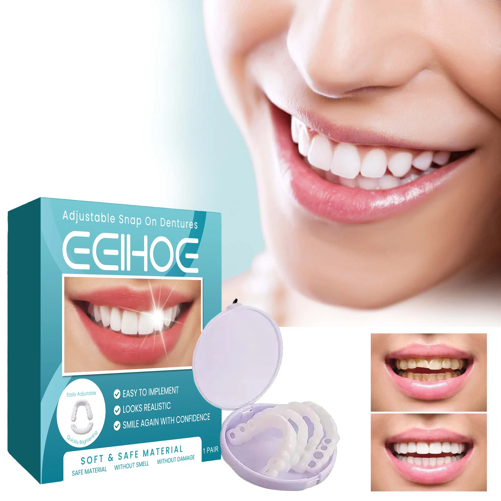 Eelhoe-Adjustable-Buckle-Braces-Temporary-Interdental-Fillings-Instant ...