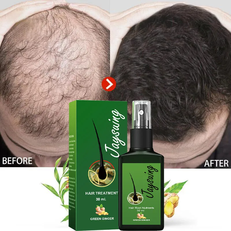 120ml-Ginger-Essential-Oil-Hair-Growth-Spray-Fast-Regrow-Anti-Hair-Loss ...