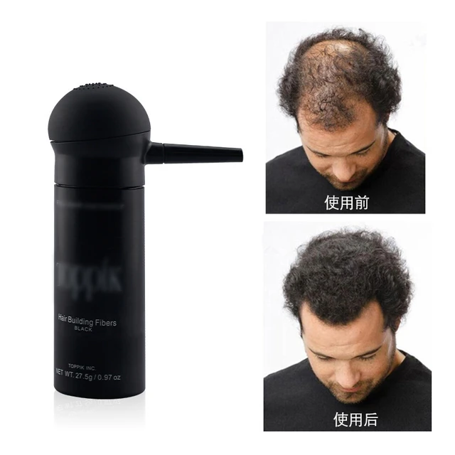 Spray On Hairline
