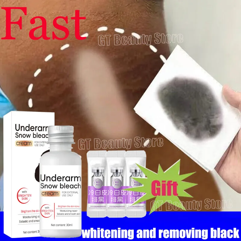 Nicotinamide-Brightening-Cream-For-Dark-Skin-Effective-Lighten-Thigh ...