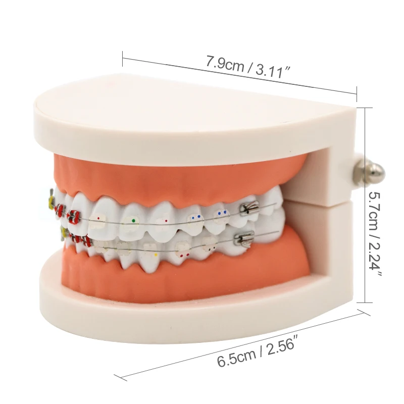 1pc-Dental-Orthodontic-Model-Half-Metal-Half-Ceramic-Braces-Crowding ...