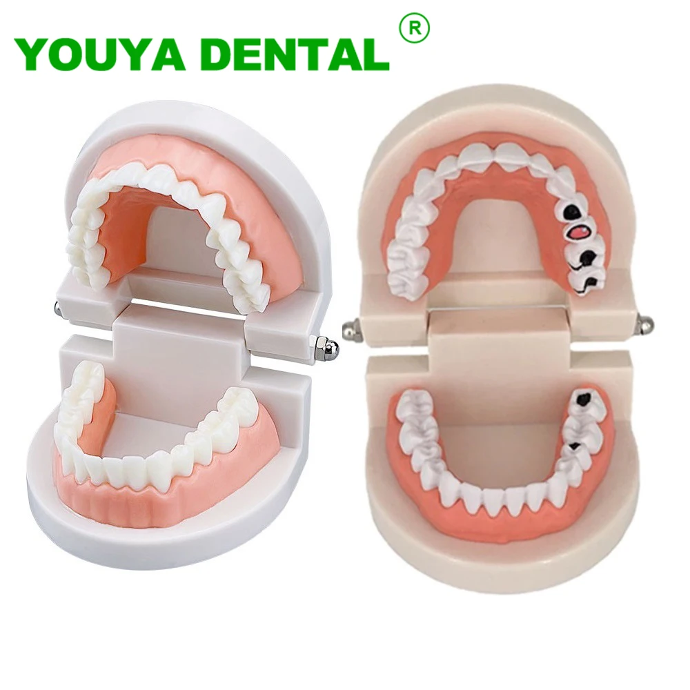 Dental-Education-Model-With-Caries-Tooth-Standard-Teeth-Model-Dentist ...