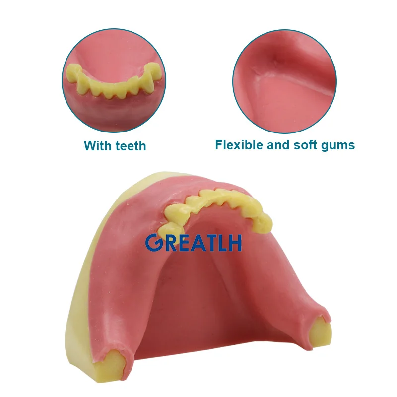 Vomerine Teeth