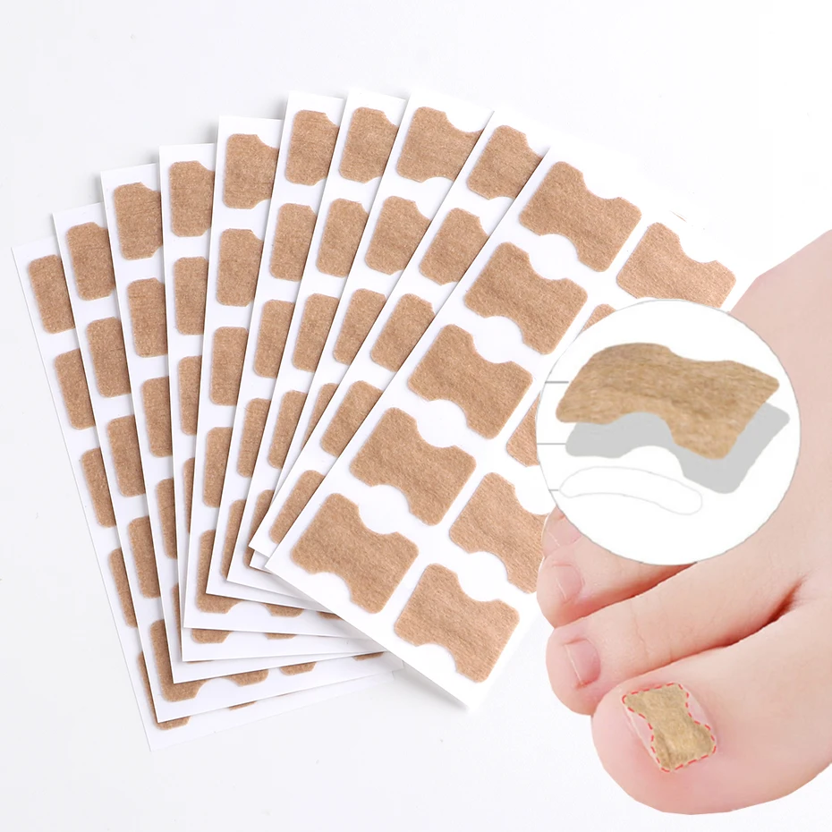 Ingrown-Toenail-Correction-Sticker-Adhesive-Toenail-Patch-Elastic-Nail ...