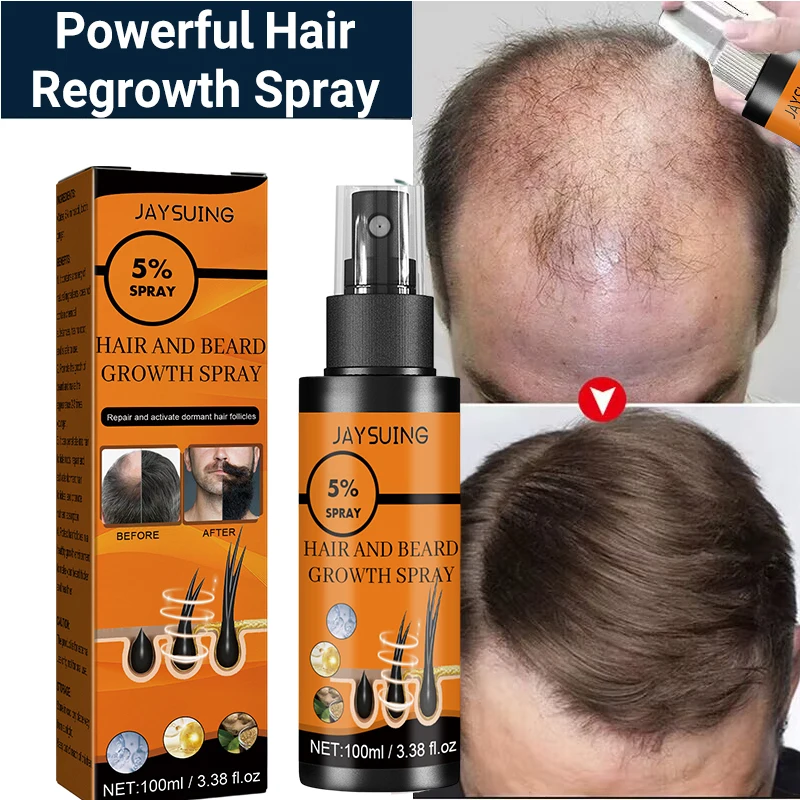 Hair-Growth-Serum-Spray-Prevent-Anti-Hair-Loss-Products-Fast-Growing ...