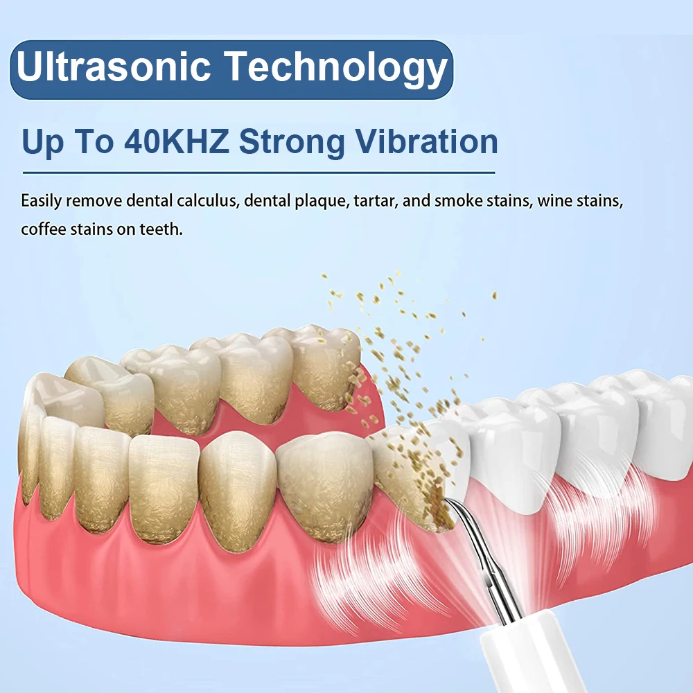 Dental Plaque Removal