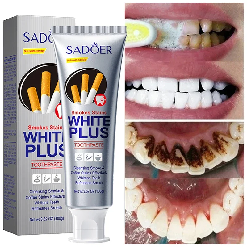 Teeth-Whitening-Toothpaste-Fast-Remove-Smoke-Coffee-Tea-Stains-Cleaning ...