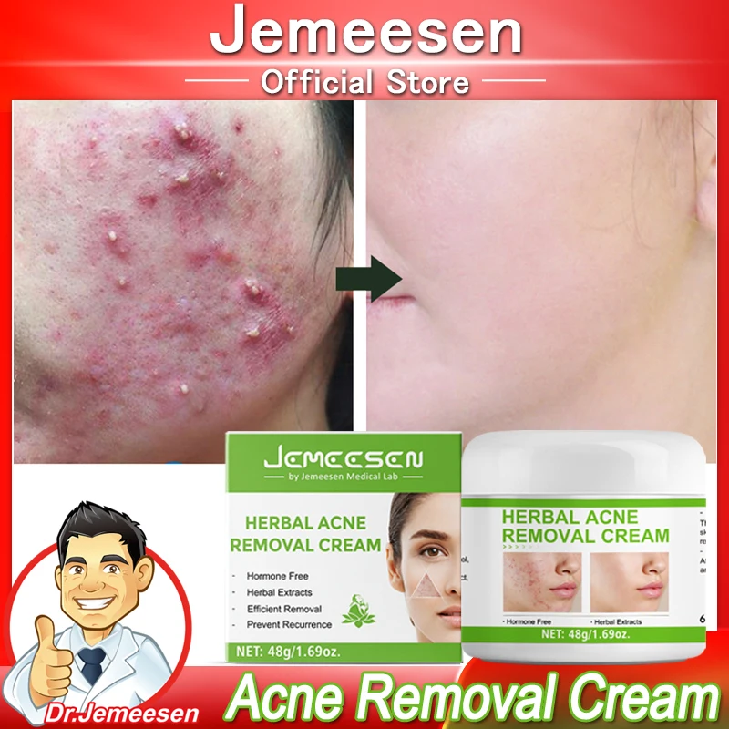 Jemeesen-Acne-Removal-Face-Cream-Control-Anti-Acne-CreamTreatment-Acne-Mark-Skin-Care-Whitening ...