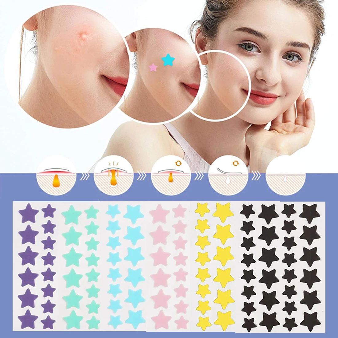 28-40pcs-Cute-Star-Acne-Patches-Colorful-Acne-Removal-Stickers-Men ...