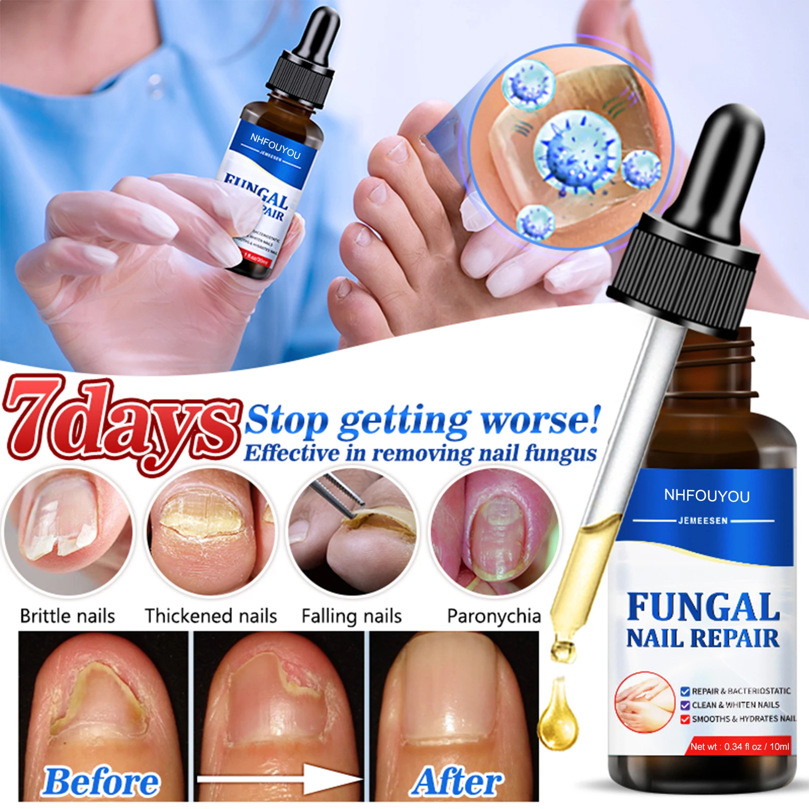 Nagel Pilz Behandlung Serum Onychomykose Paronychie Anti Infektion Zehe ...