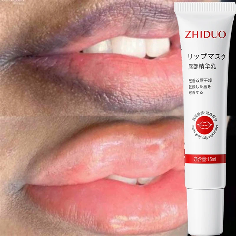 Lips-Pink-Fresh-Lightening-Bleaching-Cream-Reduce-Pigmentation-Remove ...