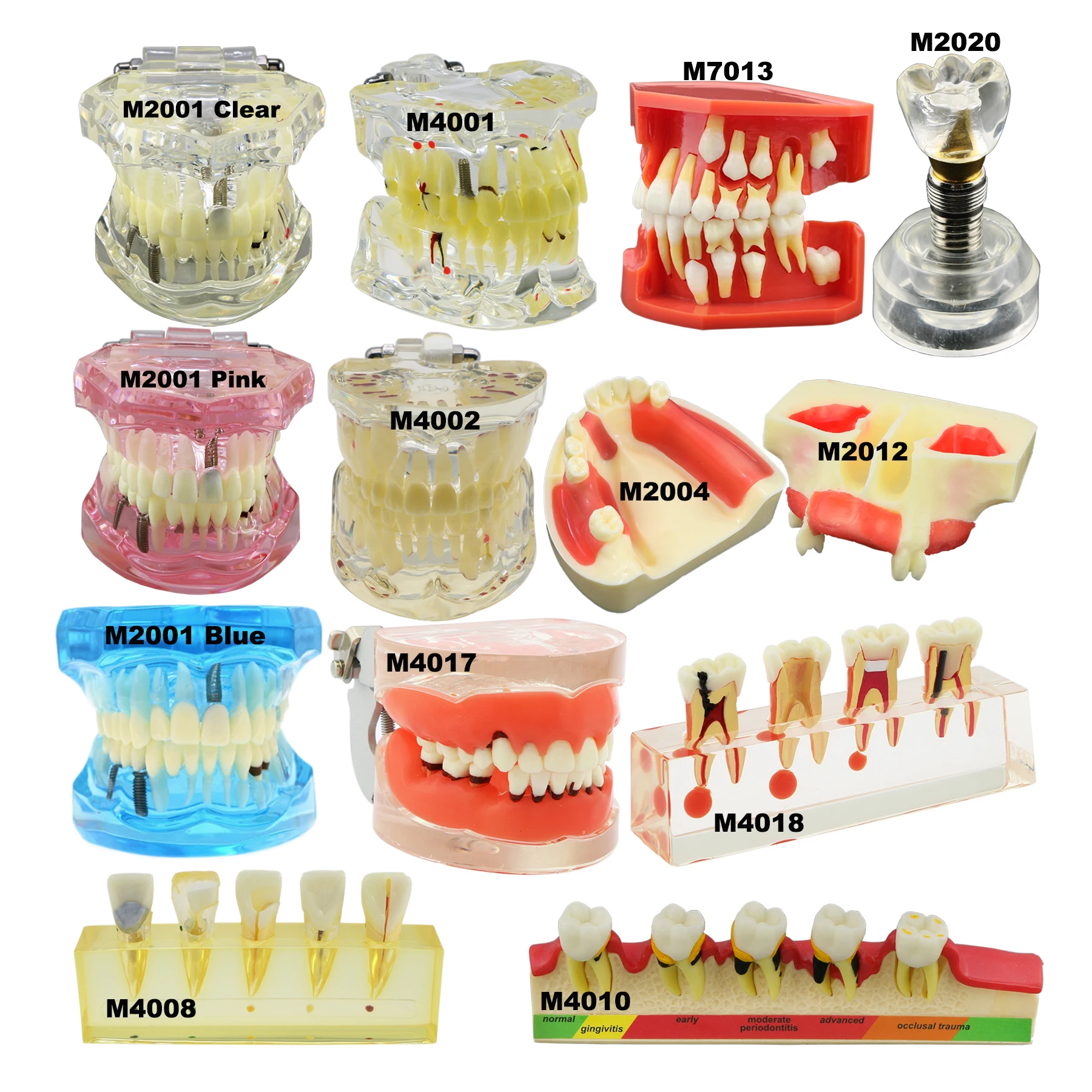 Dental-Typodont-Teeth-Model-Implant-Restoration-Periodontal-Disease ...