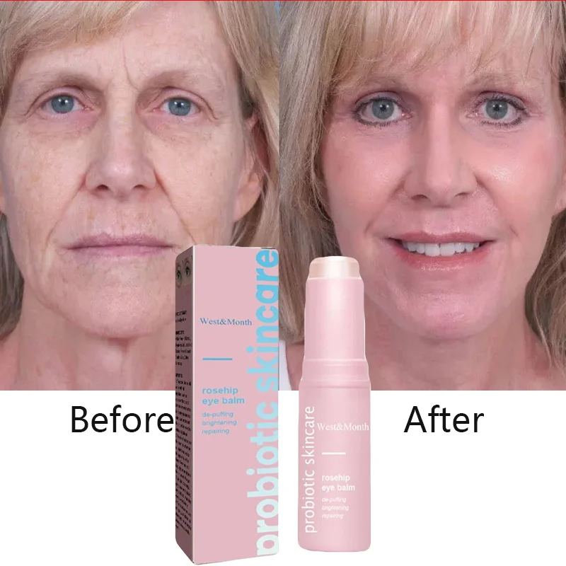Instant-Wrinkle-Removal-Multi-Bounce-Balm-Facial-Tightening ...