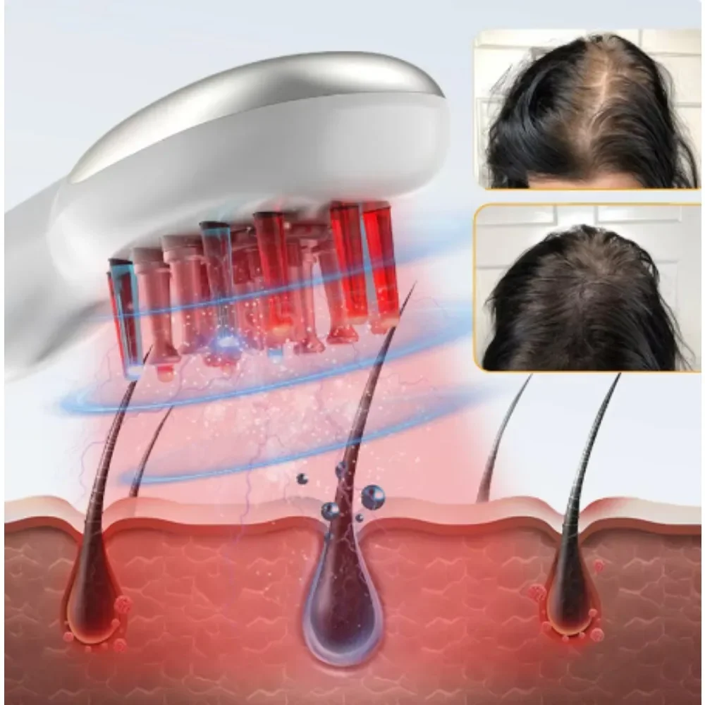 Phototherapy Micro-Current Hair Growth Comb Mino Medicine Supplying ...