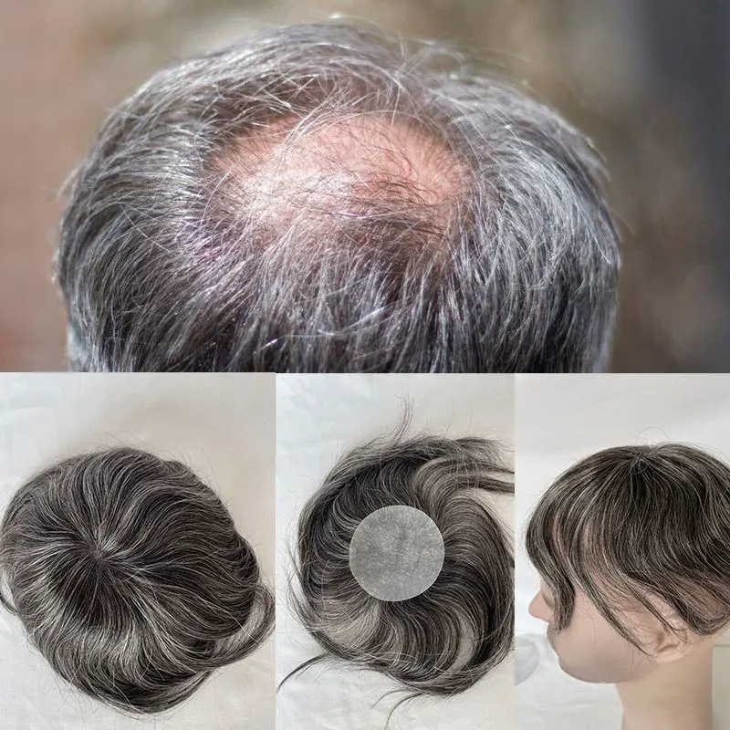 Side-or-Back-Hair-Patches-for-Men-Hairpiece-for-Men-Cover-Bald-Spot-On ...